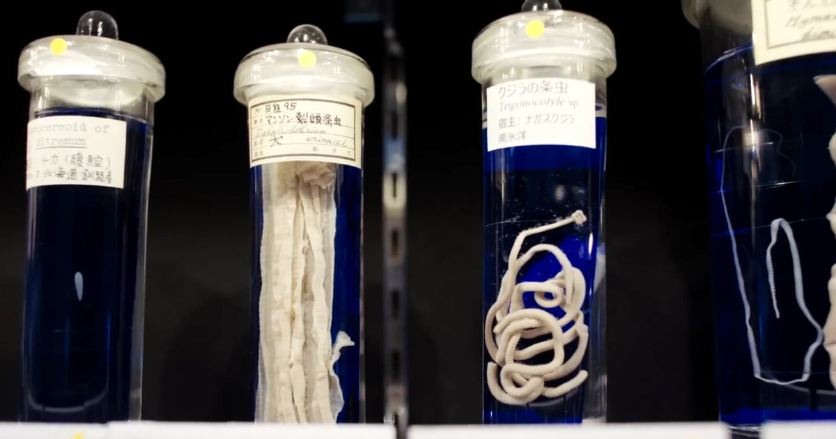 In Tokyo I toured the largest parasite museum | Bill Gates